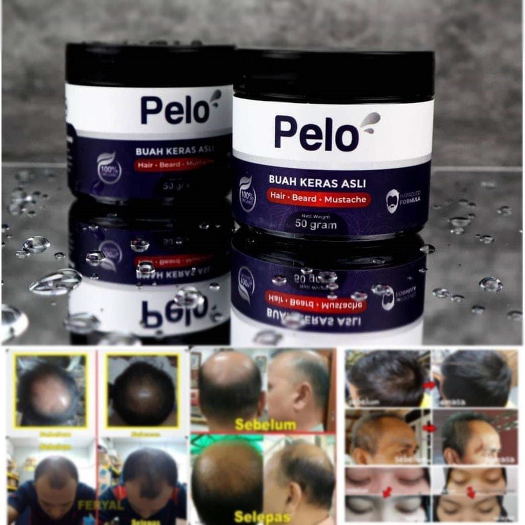 💥ORIGINAL HQ💥 PELO BALM - PELEBAT RAMBUT DAN JAMBANG, MERAWAT MASALAH ...