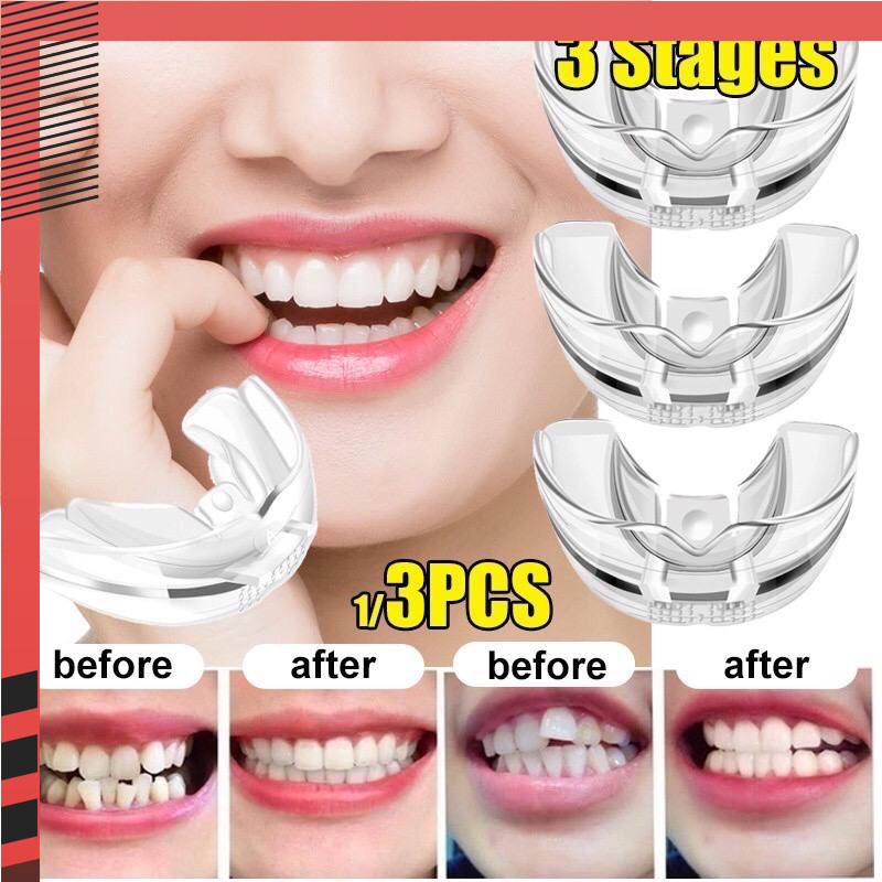 [LS] TEETH TRAINER ALIGNMENT,sesuai utk kanak2-dewasa, cantikkan gigi ...