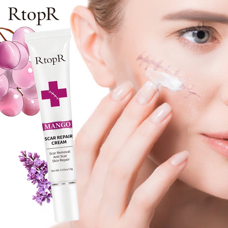 RtopR Scar Repair Cream Acne Scar Treatment Face Face Cream Repair Skin ...