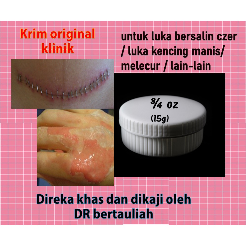 KRIM MINYAK KLINIK!!! Krim MINYAK Luka Czer/Pembedahan Bersalin Normal ...