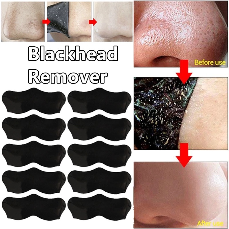 Blackhead Remove Mask Peel Nasal Strips Deep Cleansing Shrink Pore Nose ...