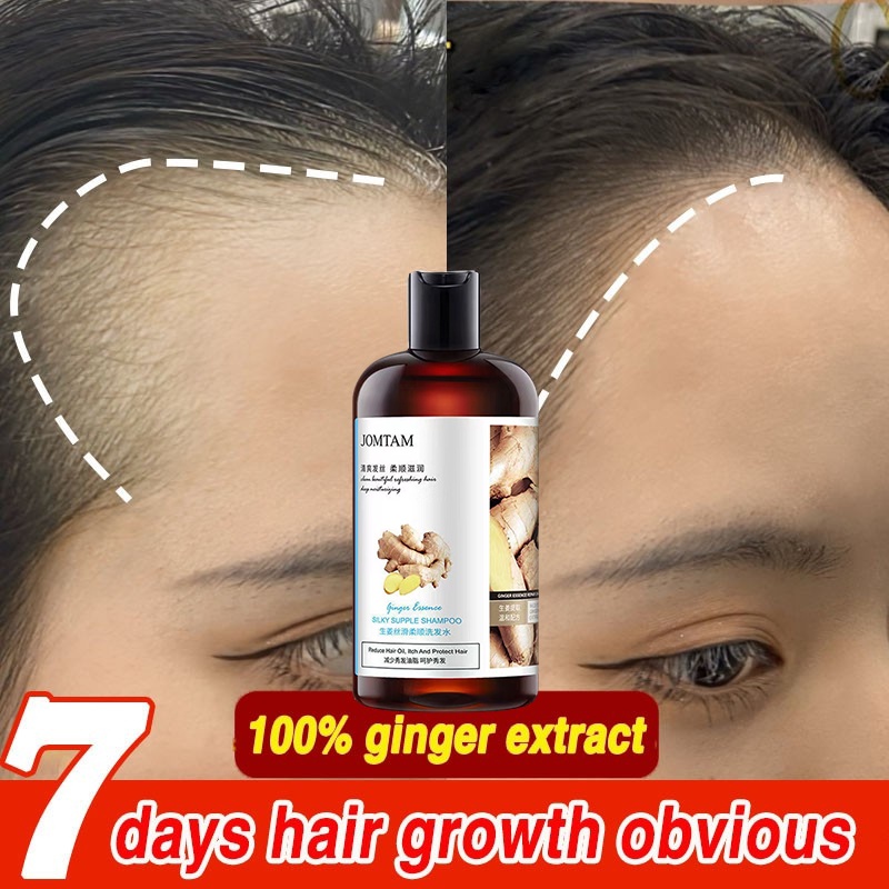 Ginger Shampoo Anti Hair Loss Refreshing Oil Control Nourishing Fast