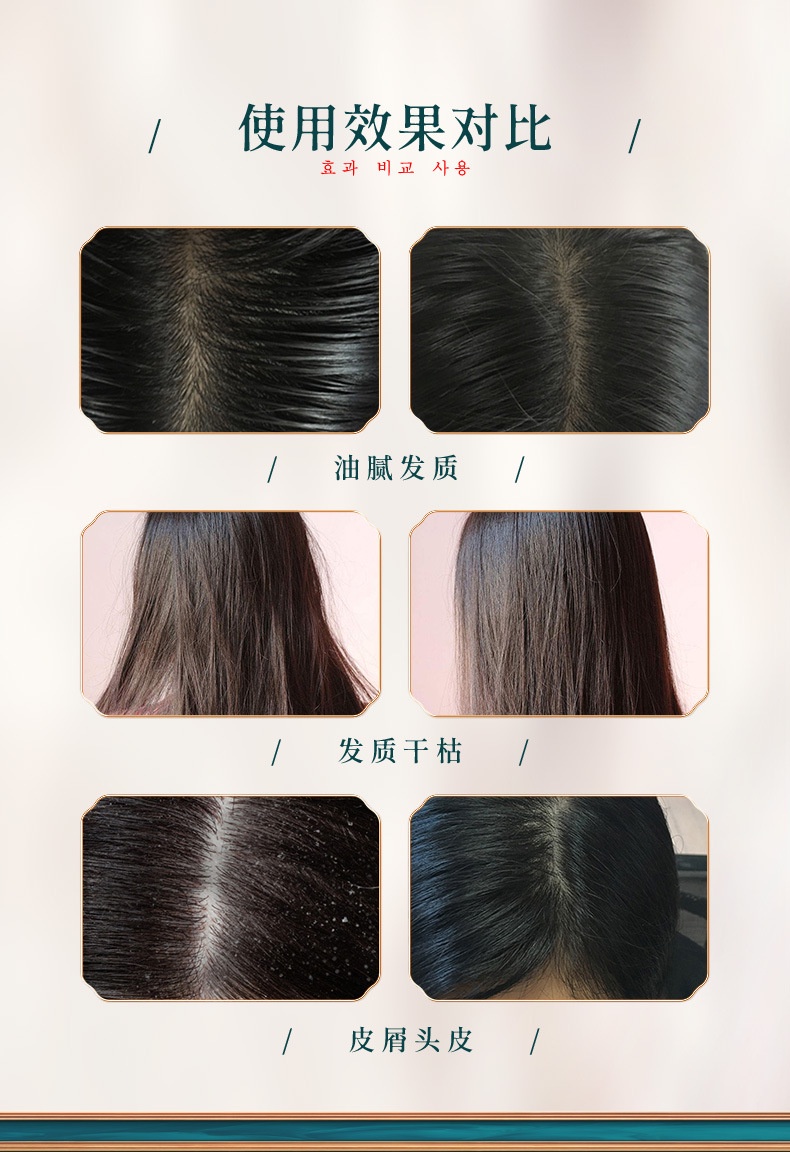 ROREC HANFEN Ginger Ginseng Polygonum Extract Deep Foam Elastic Soft ...