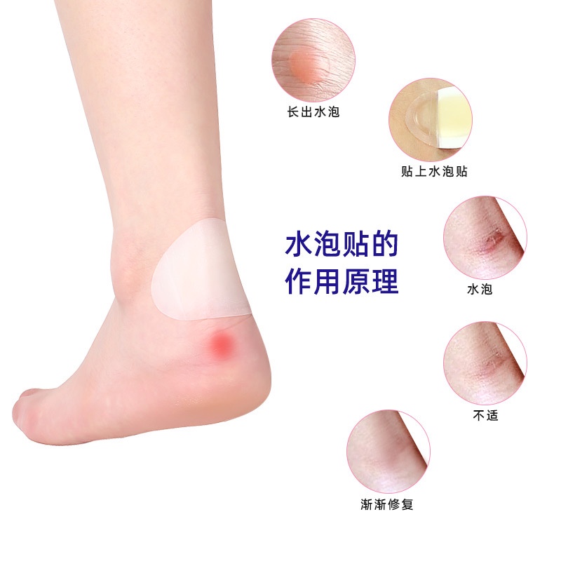 Blister Sticker Heel 水泡贴 Pelekat Lepuh | Shopee Malaysia