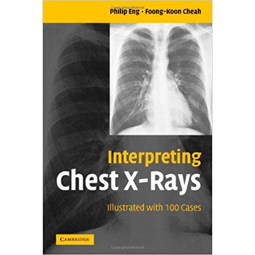 Interpreting Chest X-Rays : Illustrated with 100 Cases | Shopee Malaysia