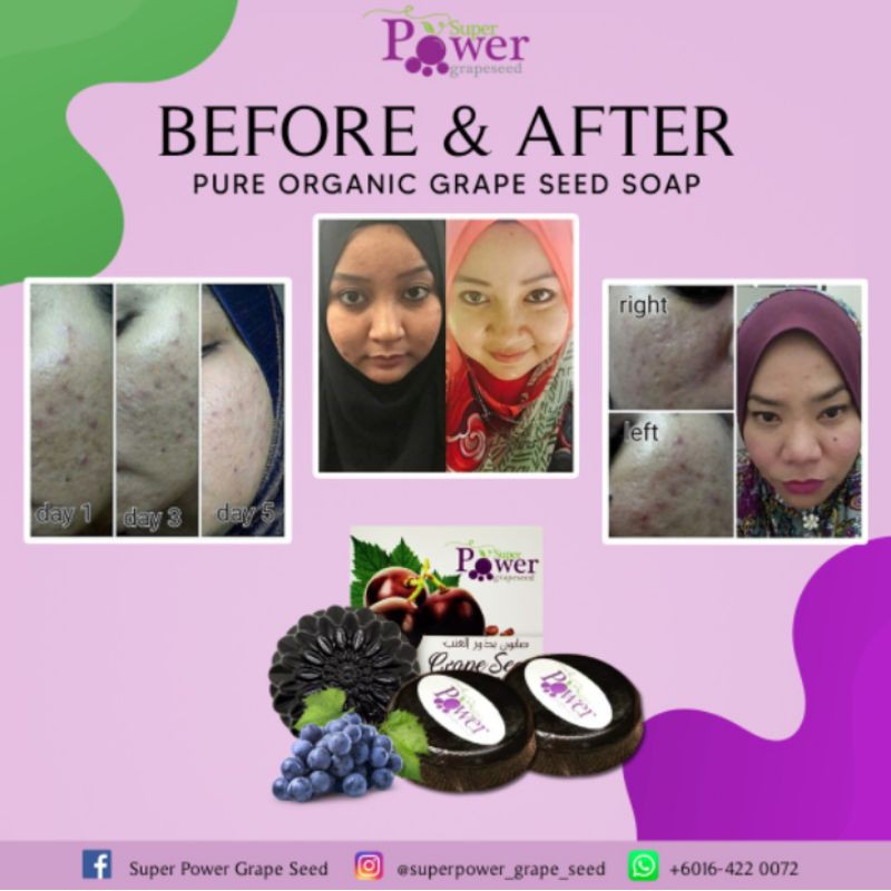 [TANPA SLES, SLS & PARABEN] Sabun Khas Utk Kulit Sensitif & Parut Hitam ...