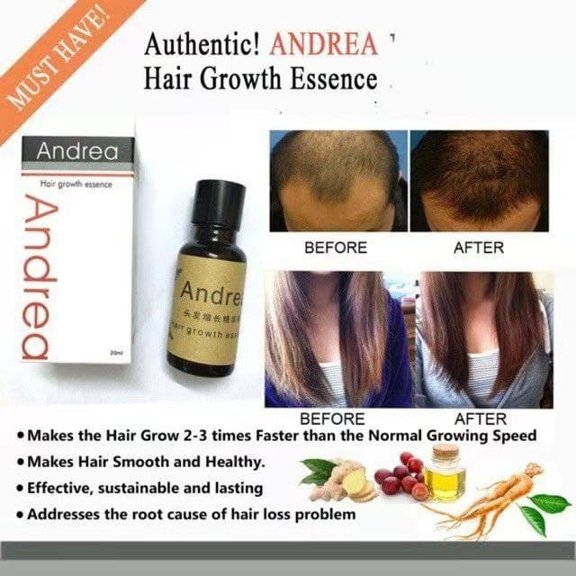Andrea Hair Growth Essence Products Essential Oil Liquid Treatment ...