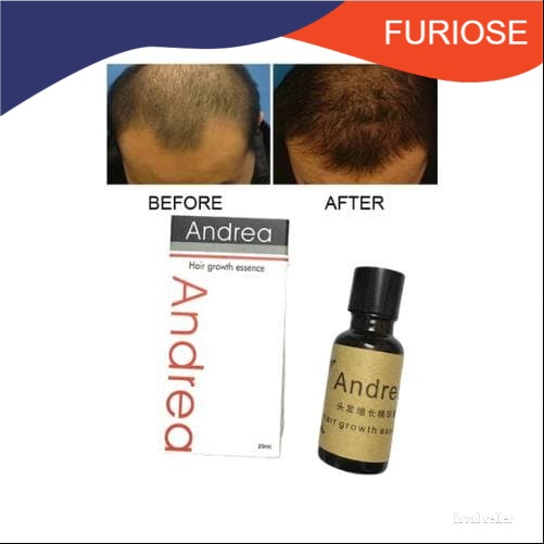Original Andrea Hair Growth Essence Dense Anti Hair Loss Liquid Essence ...