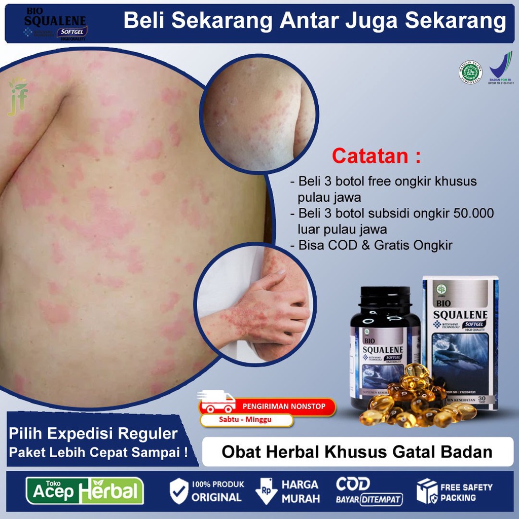 Itching Medicine Full Body Wet Eczema Itching Rash Psoriasis Scabies ...
