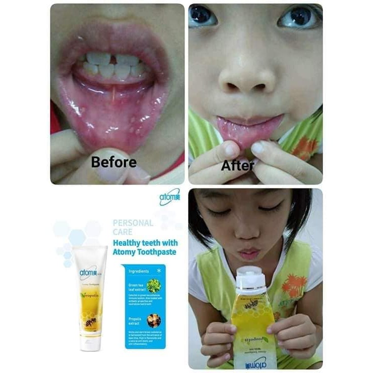 Atomy Toothpaste 200g OR 50g ubat gigi For Oral Care (Removes dental ...