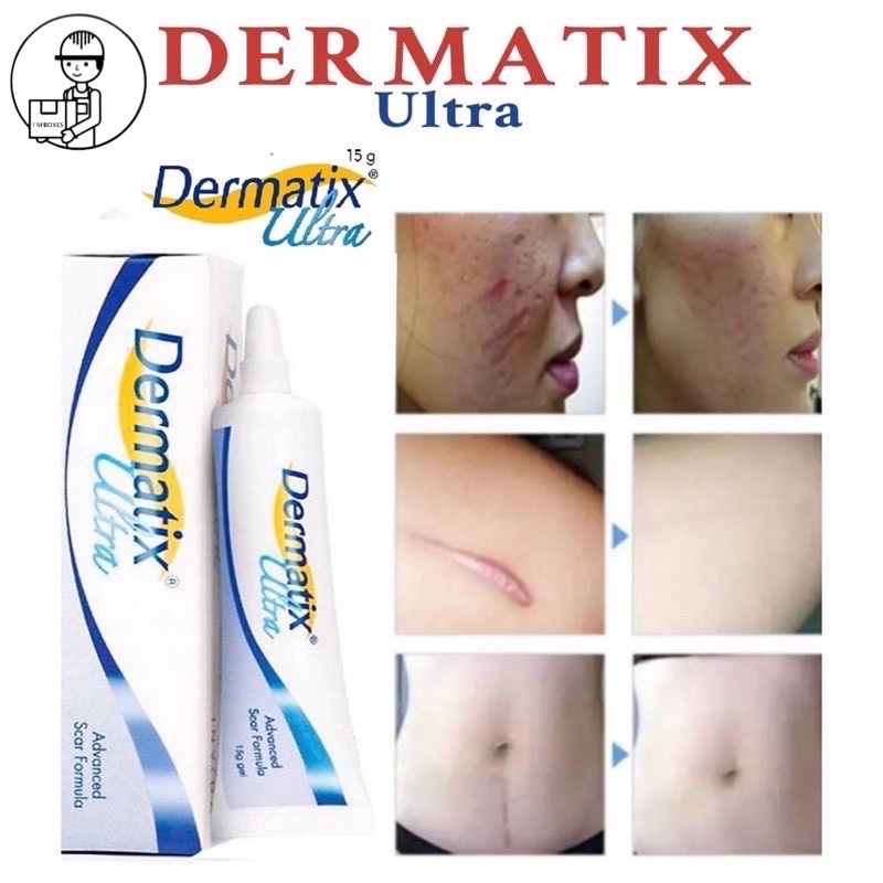 Dermatix Ultra gel 15g Advance Scar Formula Removal Repair Skin Care ...