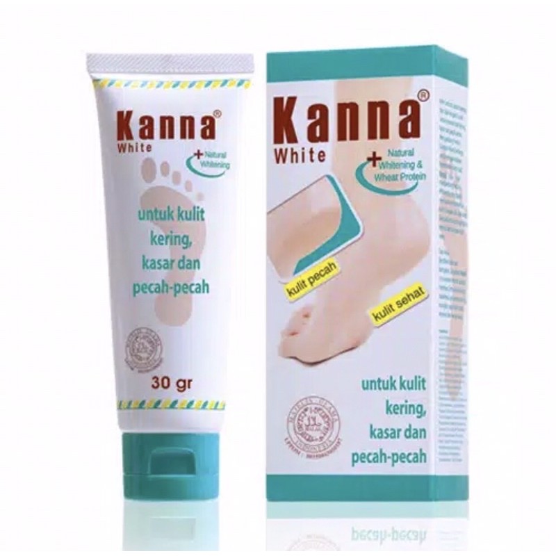 Kanna white cream 15 grams & 30 grams (whitens & softens cracked feet ...