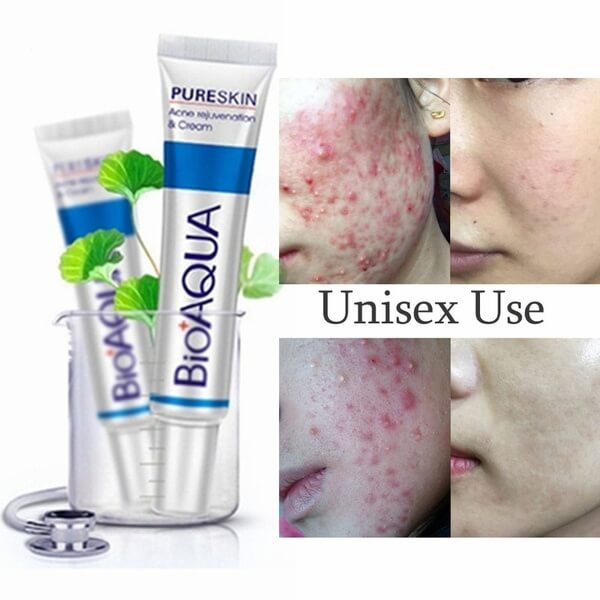 BIOAQUA Acne Rejuvenation Cream/ Acne Removal/ Whitening Moisturizing ...