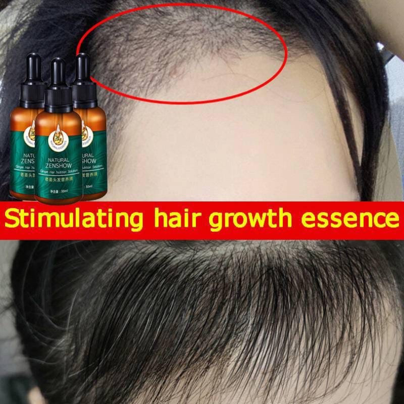 Ginger Hair Growth Essential Oil Herbal Hair Care Anti Hair Loss Repair