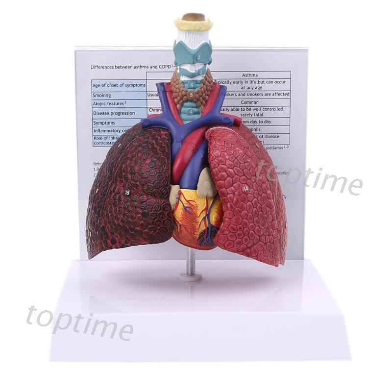 Life Size Human Lung Model Anatomical Respiratory System Anatomy ...