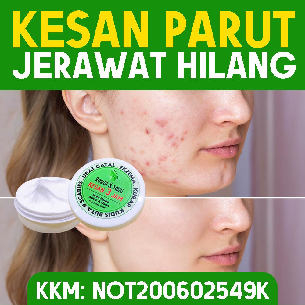 Ubat Parut, Jeragat, Jerawat, Krim Gatal, Kudis, Ruam, Elergik, Kulat ...