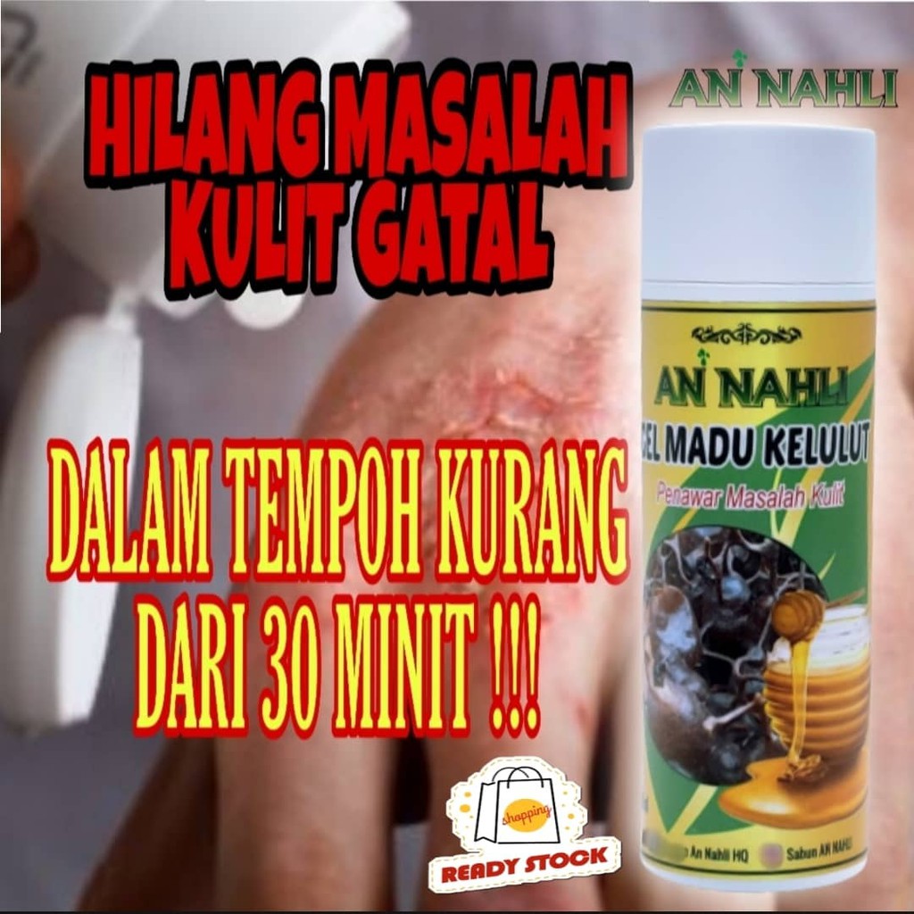 (READY STOCK)Gel Madu Kelulut An Nahli-ekzema,psoriasis,kurap,panau ...