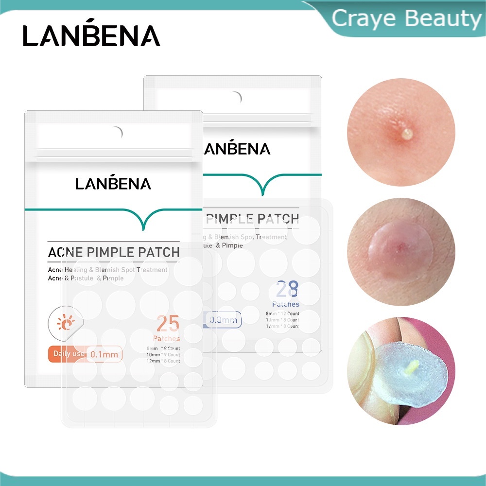 【LANBENA】【MALAYSIA READY STOCK 】ClearFit Waterproof Acne Pimple Master ...