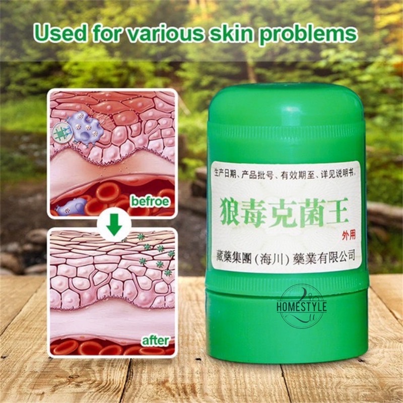 Skin Psoriasis Eczma Cream for All Kinds of Skin Problems Chinese ...