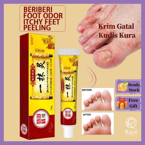 RUYII Krim Gatal Kudis Kurap 癣药膏 止痒乳膏 Psoriasis Cream Relief Itching ...