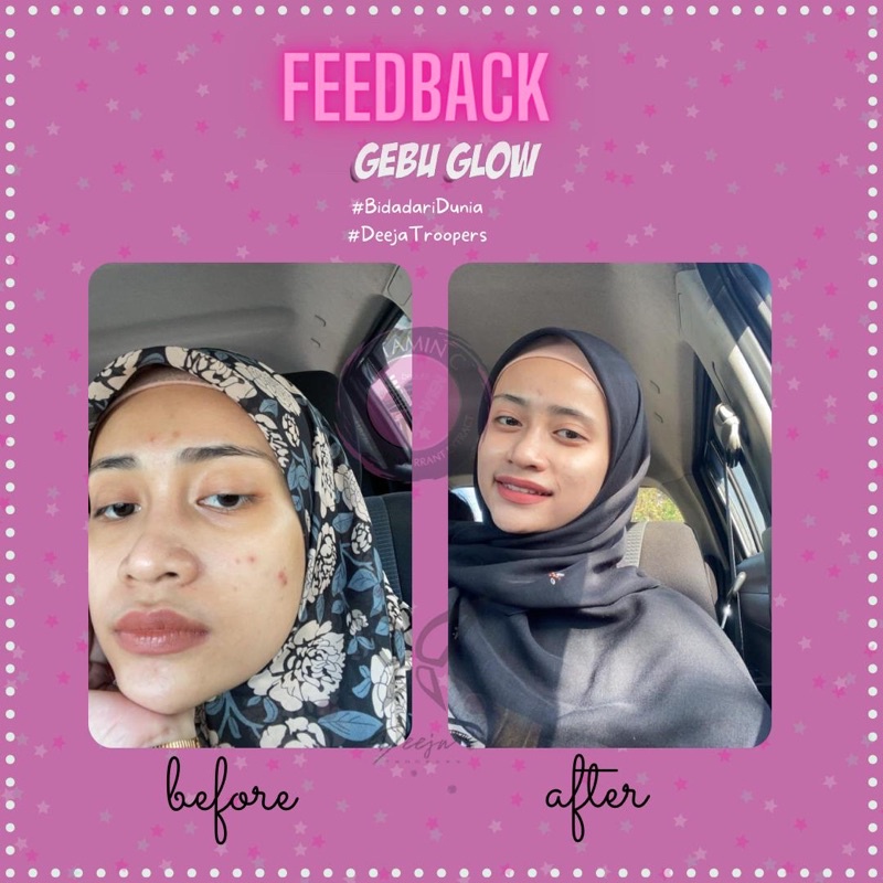 gebu glow vitamin c ORIGINAL HQ | Shopee Malaysia