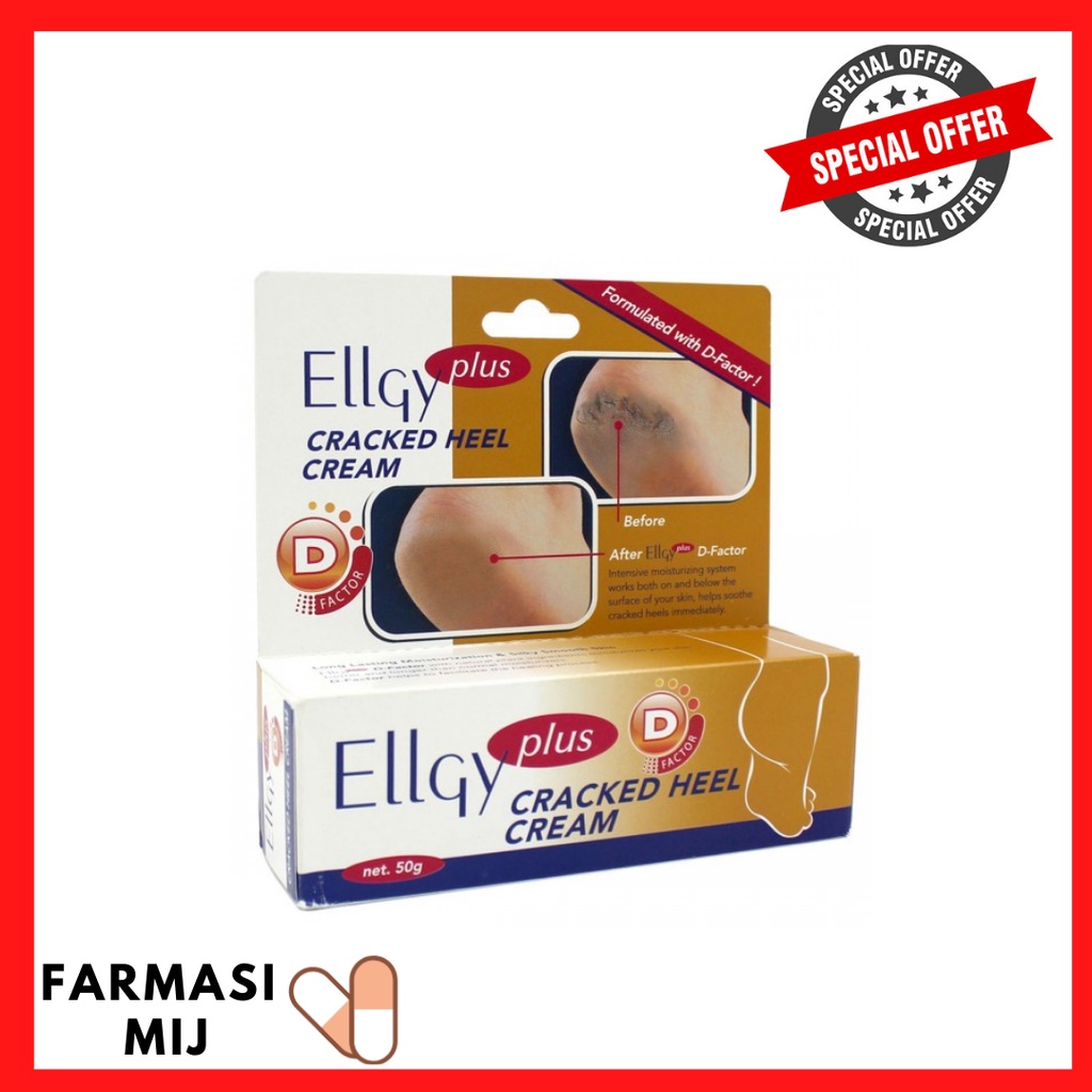 ELLGY PLUS CRACKED HEEL CREAM 50G (EXP:10/2026) | Shopee Malaysia