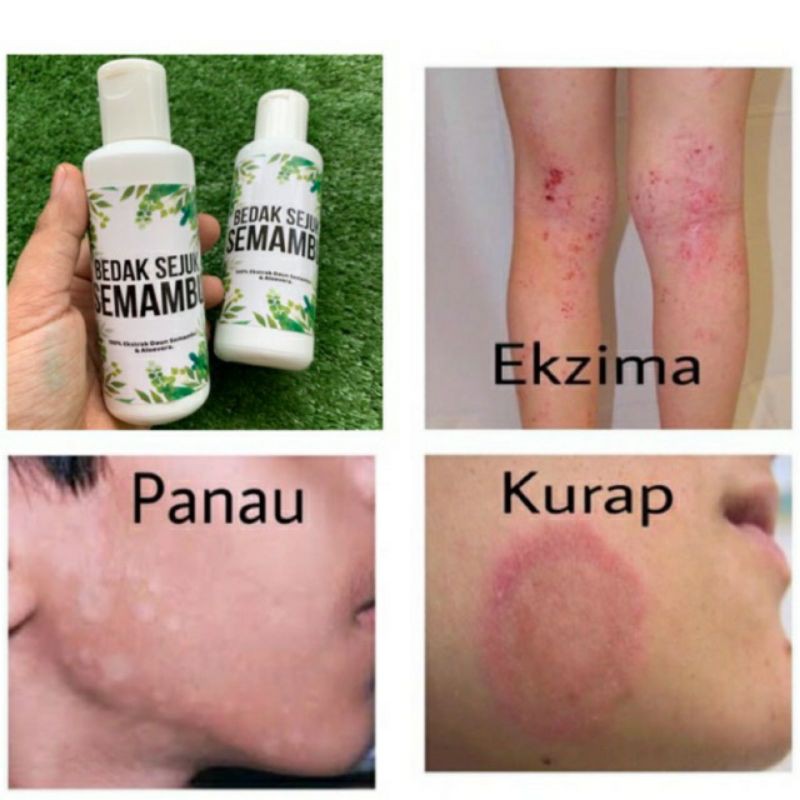 BEDAK SEJUK SEMAMBU 35ML & SABUN SEMAMBU 20g | Shopee Malaysia