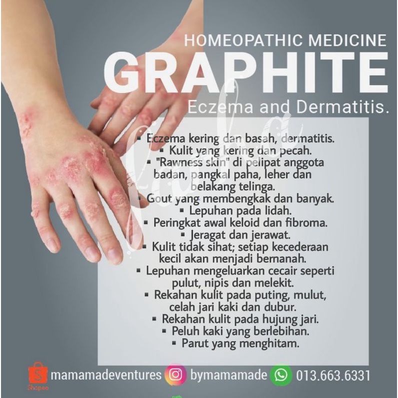 GRAPHITES Homeopathic Cream Eczema Dermatitis 25g | Shopee Malaysia