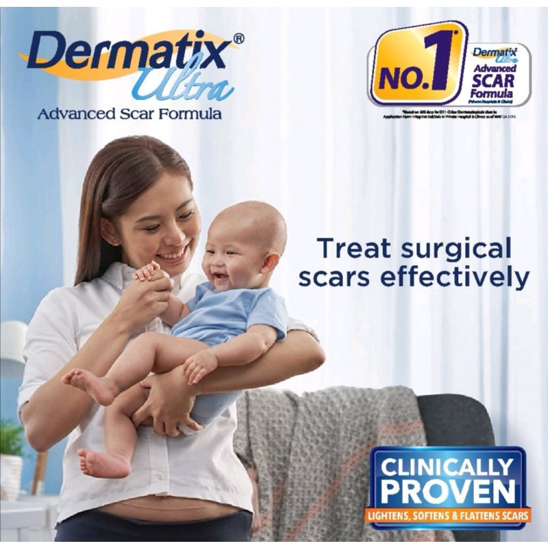 Dermatix Ultra Gel 15g Scar Hilang Parut Cepat | Shopee Malaysia