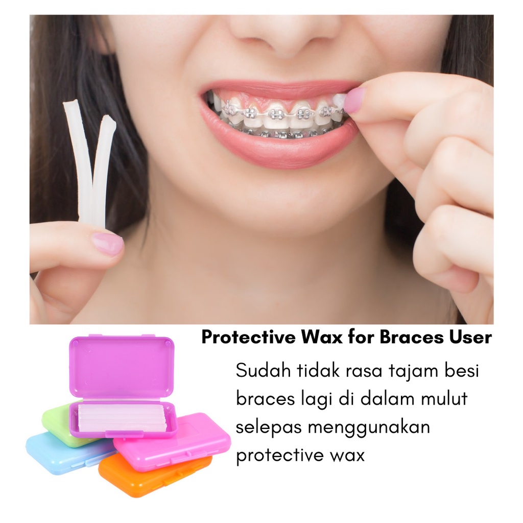 Orthodontic Wax For Braces User in Original Flavor and White Ulser Besi ...