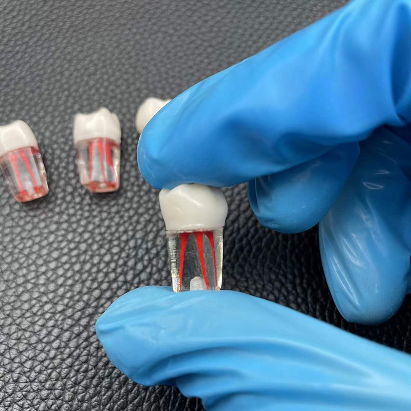 Dental Tooth Model Root Practice Pulp Cavity Clear Resin Teaching Teeth ...