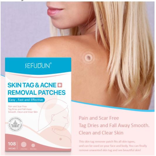 SKIN TAG & ACNE REMOVAL PATCHES Pelekat tanggal Biji kolestrol / Kutil ...