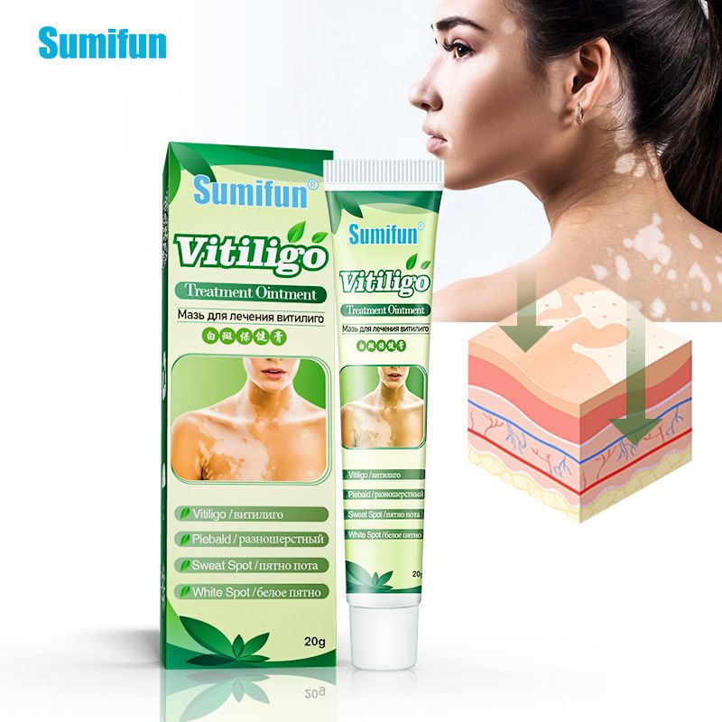 Sumifun Vitiligo Cream Vitiligo Care Cream Skin Vitiligo Psoriasis ...