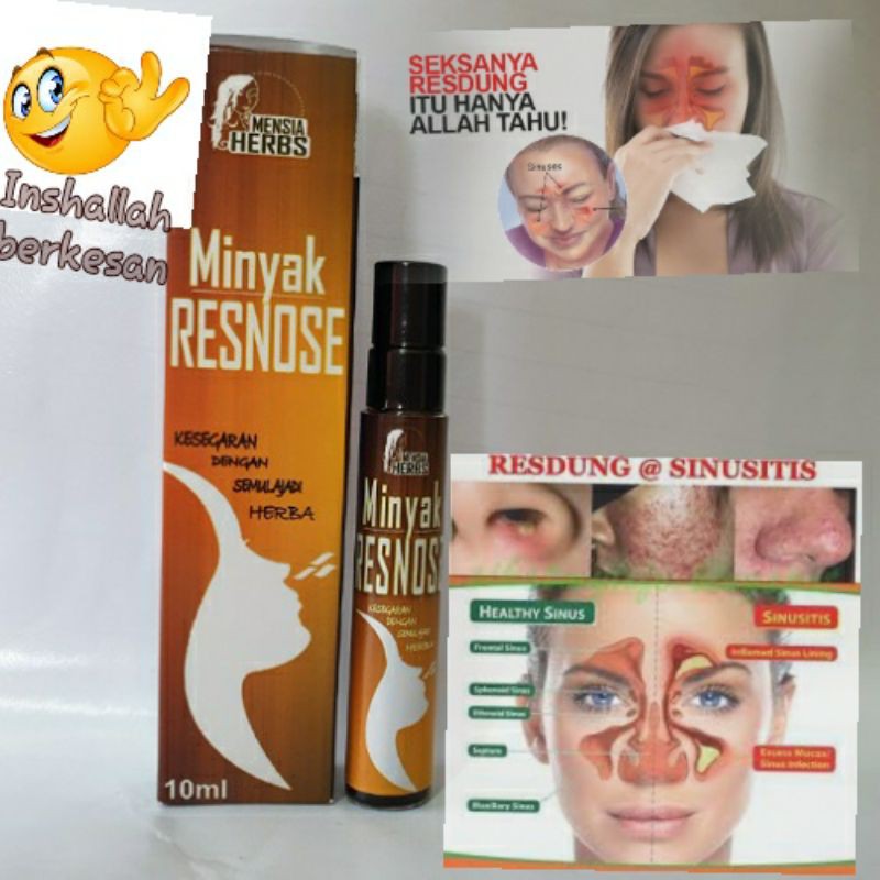 💚480buyer💚Minyak Resdung/Minyak Resnose 10ml ( spray ) | Shopee Malaysia