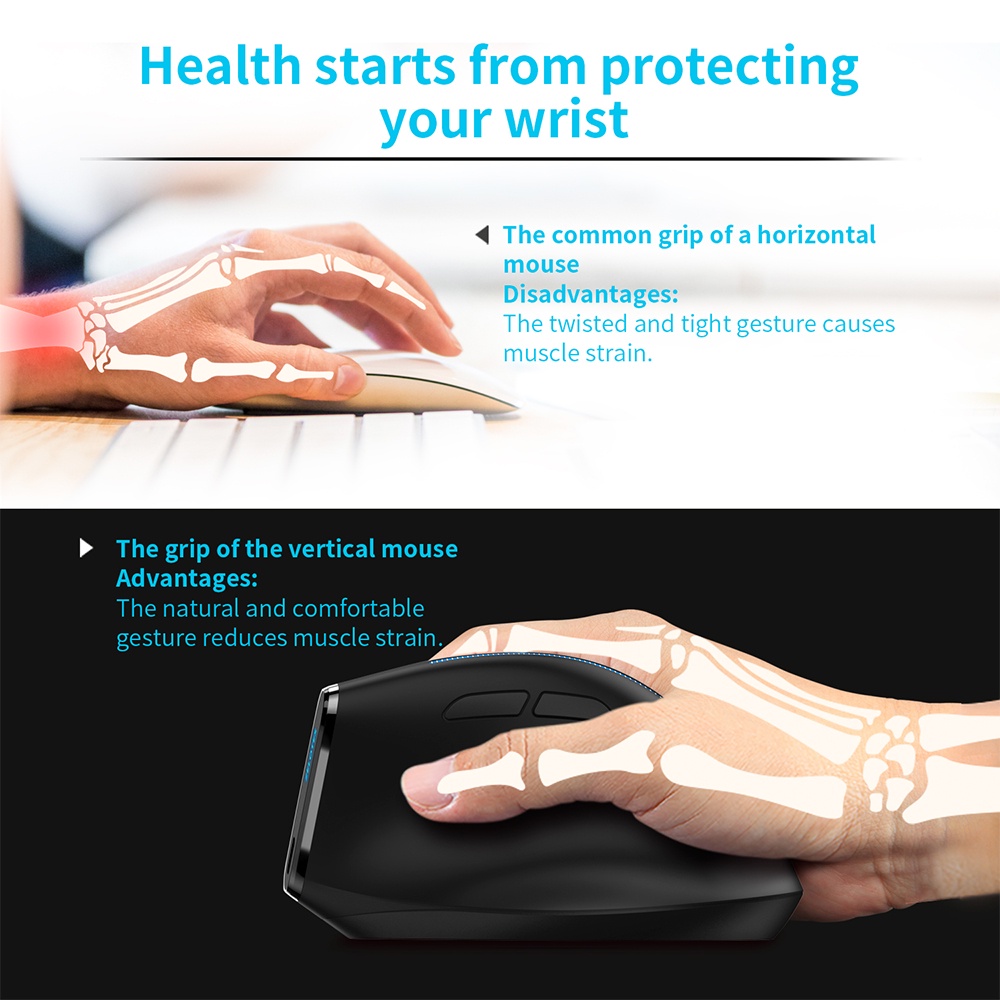 VICTSING F36A Vertical Ergonomic 2.4G Wireless Mouse 3-gear DPI LED ...