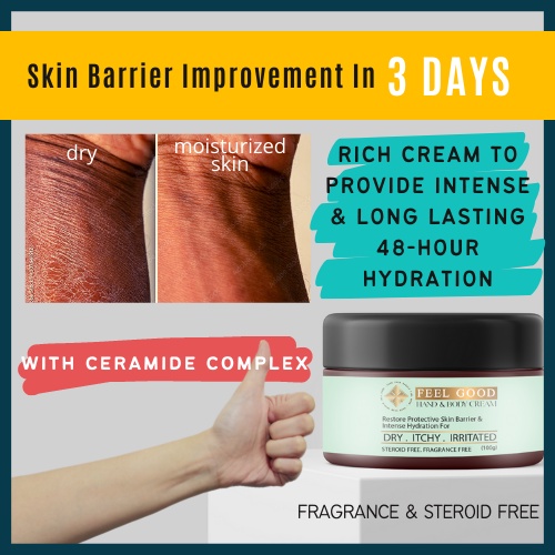 [𝐁𝐄𝐑𝐊𝐄𝐒𝐀𝐍] Dry Skin Eczema Cream Sensitive Krim Gatal Kulit Kering Bersisik Ubat Kulit Licin ...