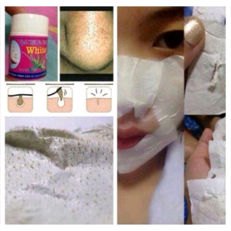 Vietnam Mask Blackhead RemoverPimples buka bintik hitam Removal Gel ...