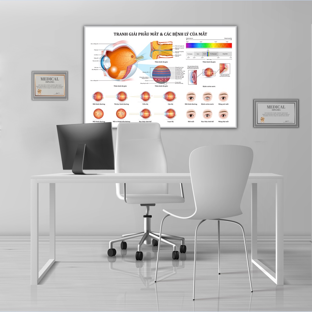 Glossy ophthalmic painting. Painting of eye diseases - 50x75cm - Decal ...