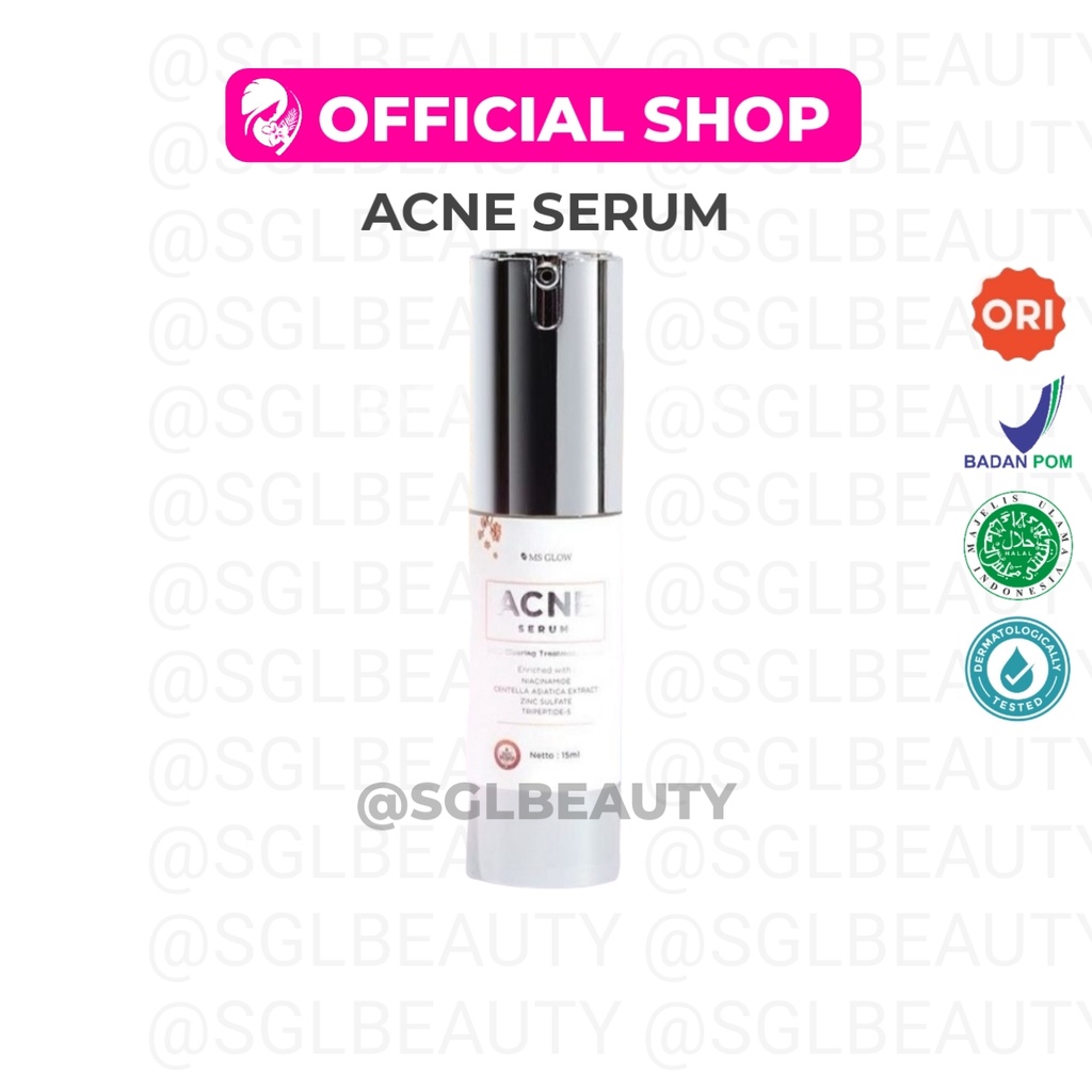Ms Glow Acne Serum - (Treats Acne-prone, Blackheads & Oily Skin, and ...
