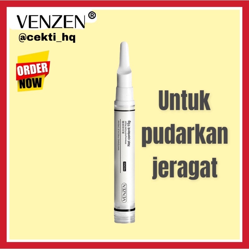 VENZEN FRECKLES CREAM | KRIM JERAGAT DAN PUDARKAN HITAM DI MUKA VENZEN ...