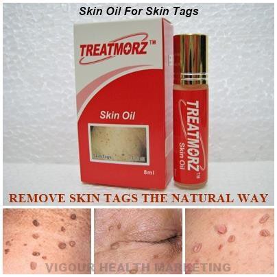 Treatmorz oil 1x8ml (BOX) | Shopee Malaysia