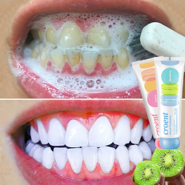 ubat gigi ukiwi toothpaste ubat gigi putih teeth whitening whitening ...