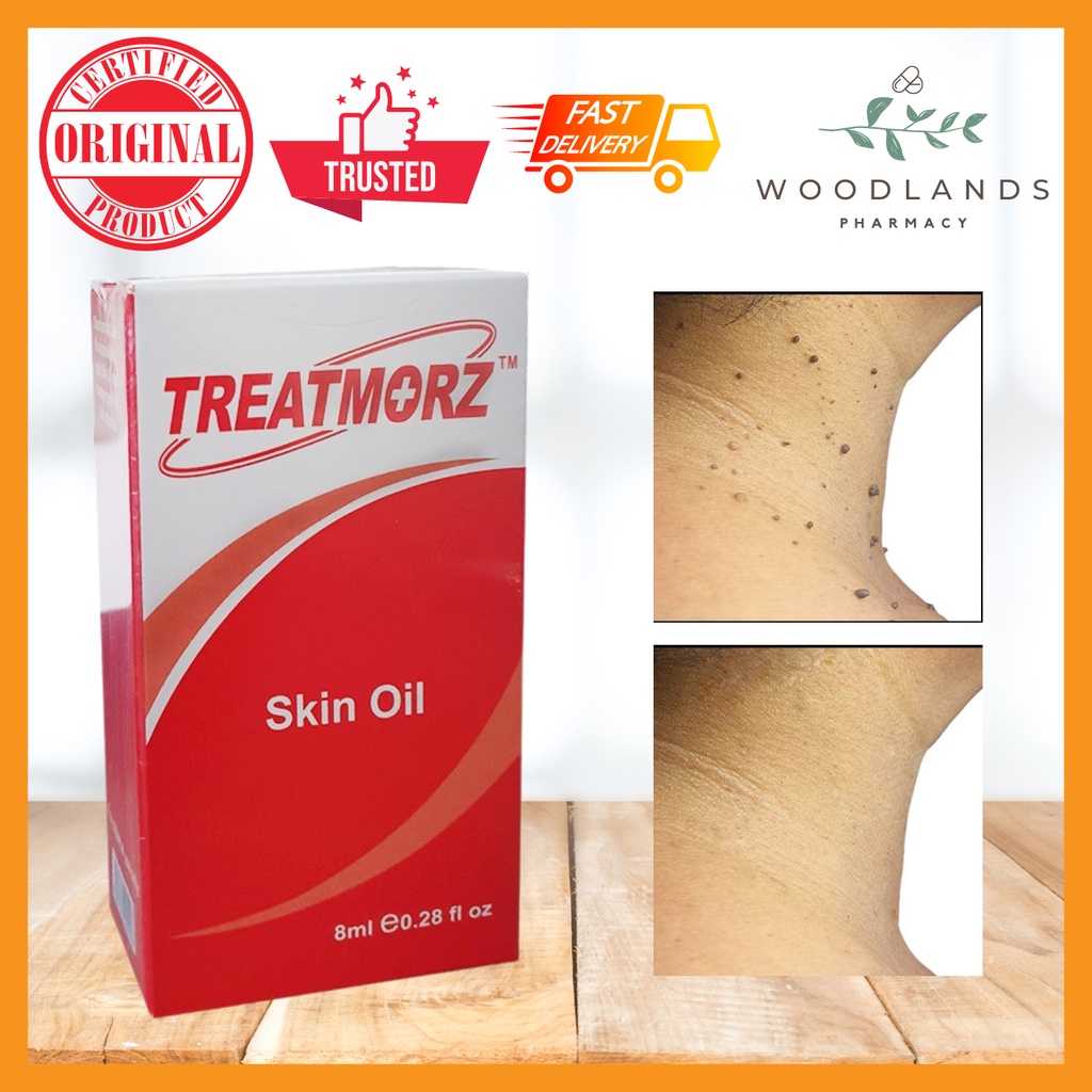 TREATMORZ SKIN OIL 8ML - SKIN TAG | Shopee Malaysia