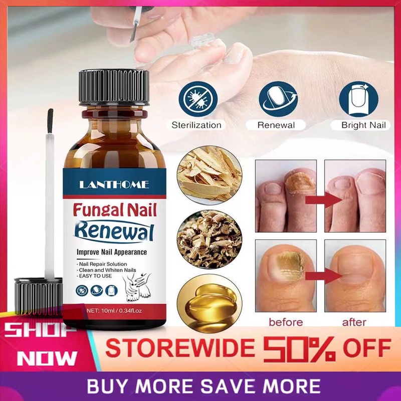 (Buy1 get free 1)Nail Fungus Treatment Nail Cream Nail Antifungal Nail ...