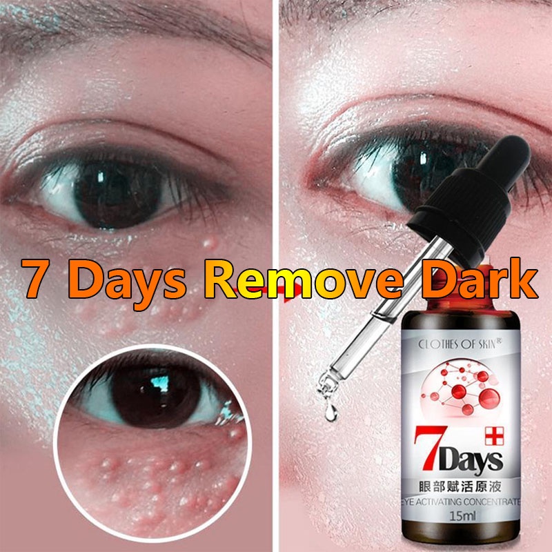 Instant Fat Removal-7 Days Eye Cream Remove Eye Bags Dark and Care Fat ...