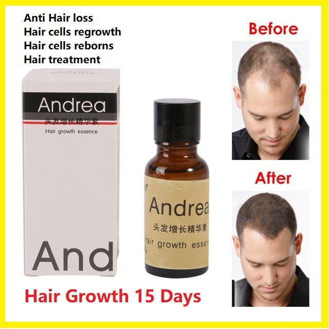 Original Andrea Hair Growth Essence Dense Anti Hair Loss Liquid Essence