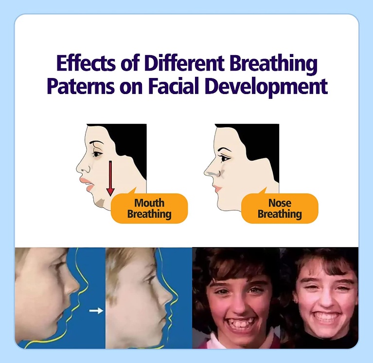 30pcs/Box Anti Snore Mouth Tape Suffocation Sleep Aid Nose Breath Train ...