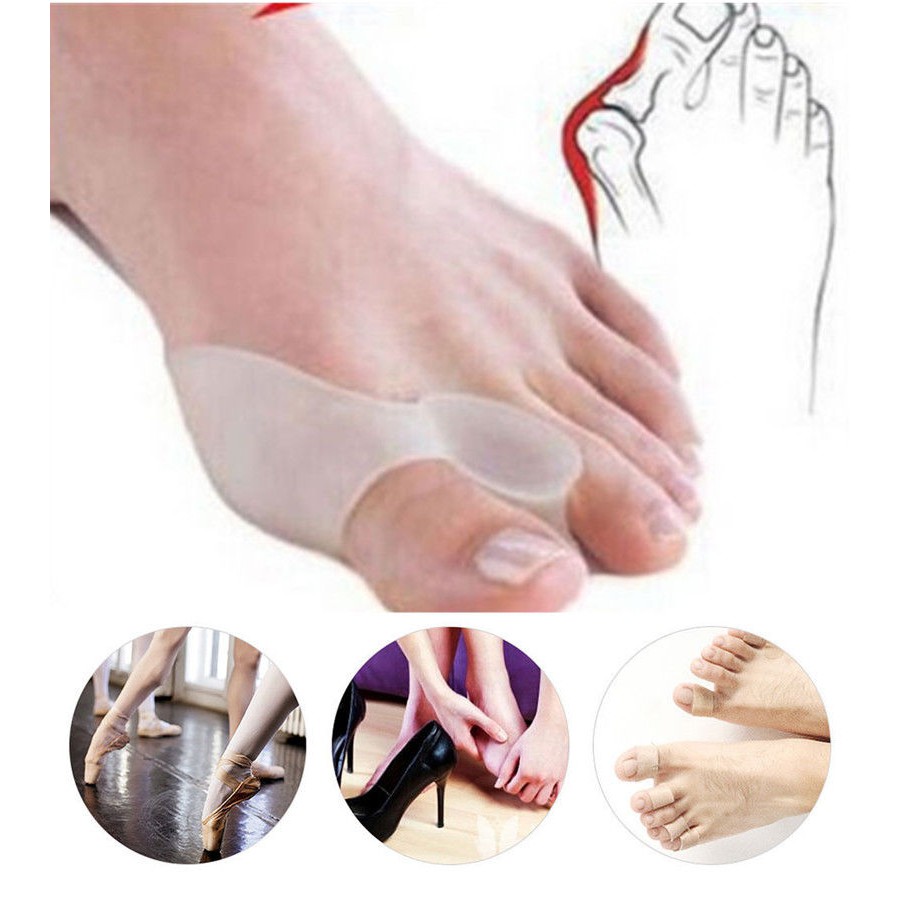 Hallux Valgus Bicyclic Bone Thumb Braces Correction Foot Big Toe ...