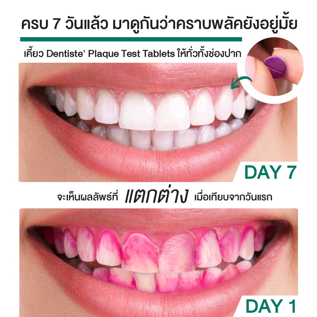 [Pack 6] Dentiste'plaque Test Dentiste Purple Tablets For Chewy Oral ...