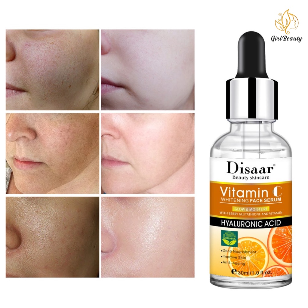 DISAAR VITAMIN C WHITENING FACE SERUM 30ML | Shopee Malaysia
